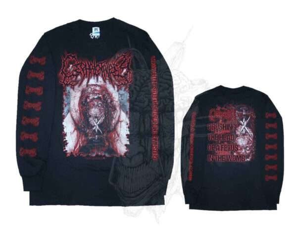 LS – CEPHALOTRIPSY – Crushing The Head Of A Fetus In The Womb ⋆ Dead ...